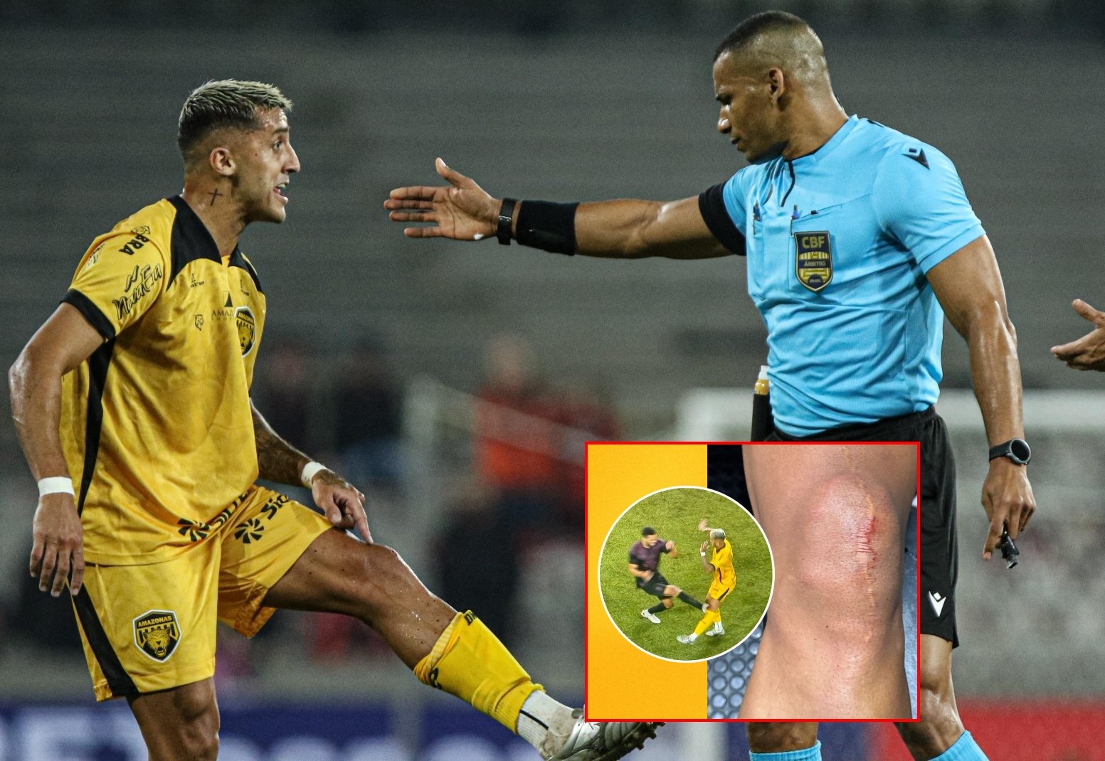 Série B: em situação semelhante à de G. Gomez, árbitro dá amarelo para ...