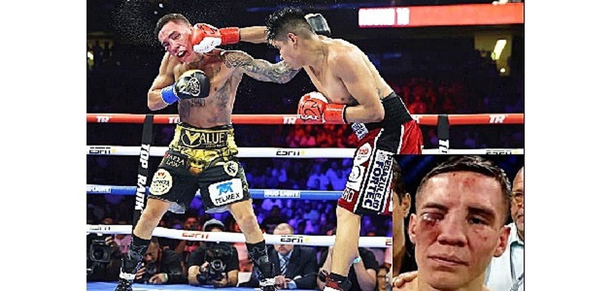 Show de Navarrete e muita garra de Valdez na melhor luta da semana ...