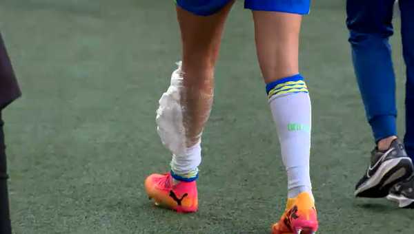 Antonia sofre fratura na fíbula da perna esquerda e está fora dos Jogos Olímpicos | olimpíadas | ge