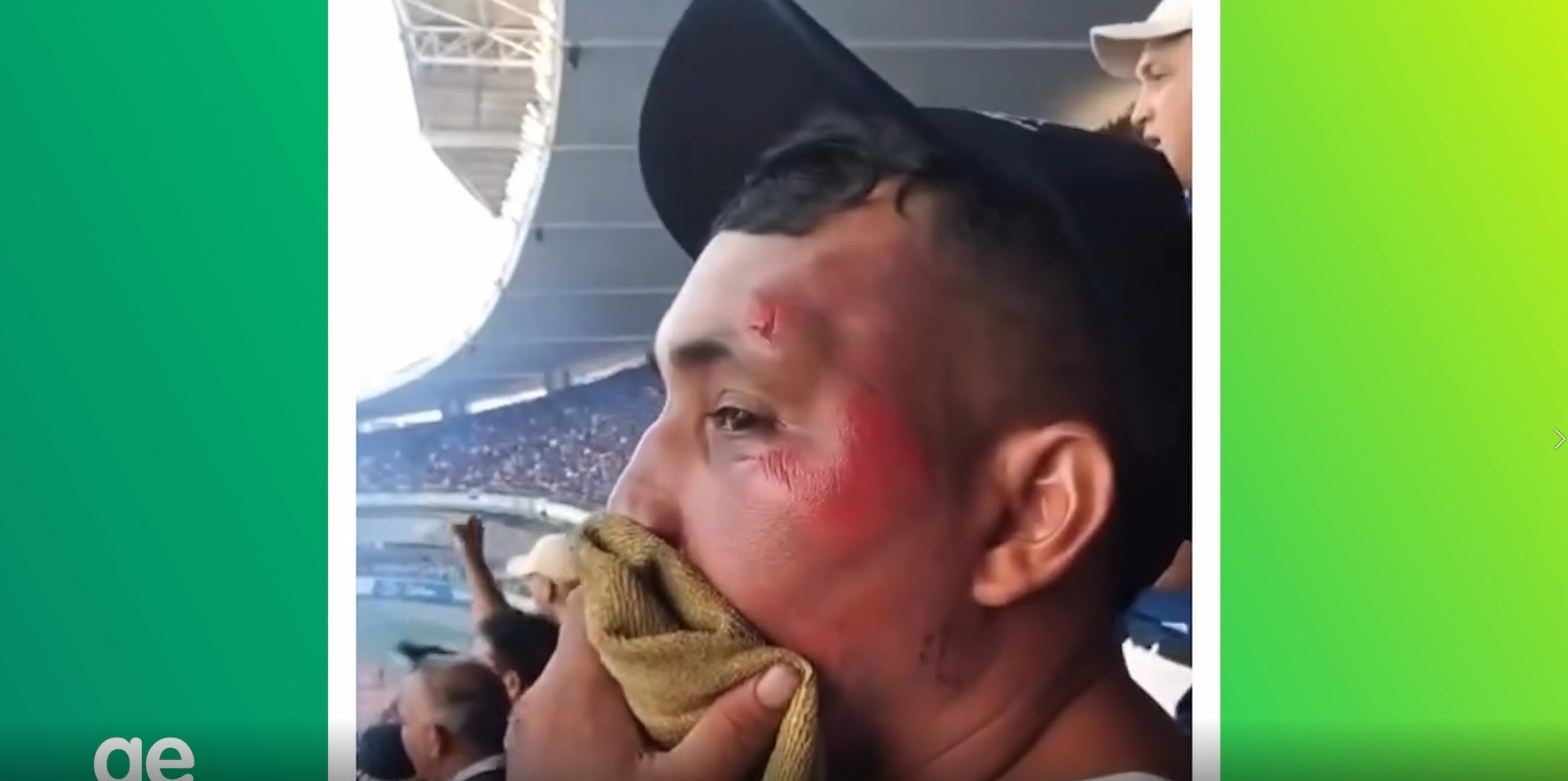 Torcedor do Remo vai ao estádio após ser atropelado por moto | Ge